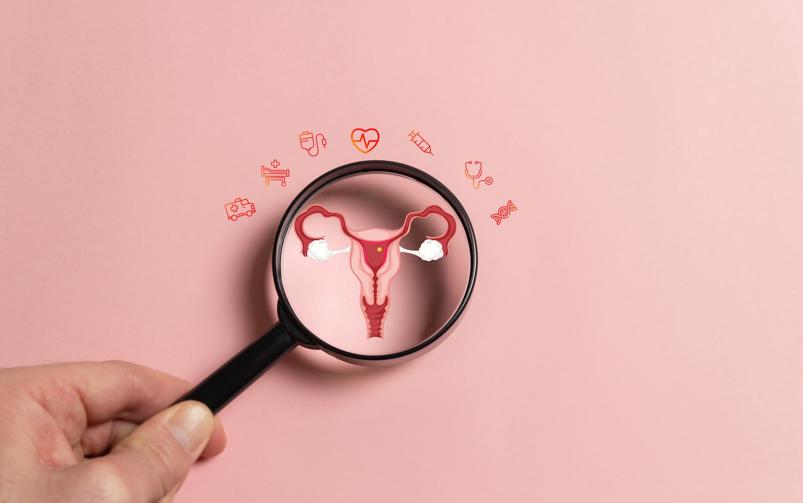 Understanding and Treating Polycystic Ovary Syndrome (PCOS) | Cho ...